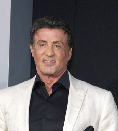 58 Celebrities with Hair Transplant (Cost, Before & After...)